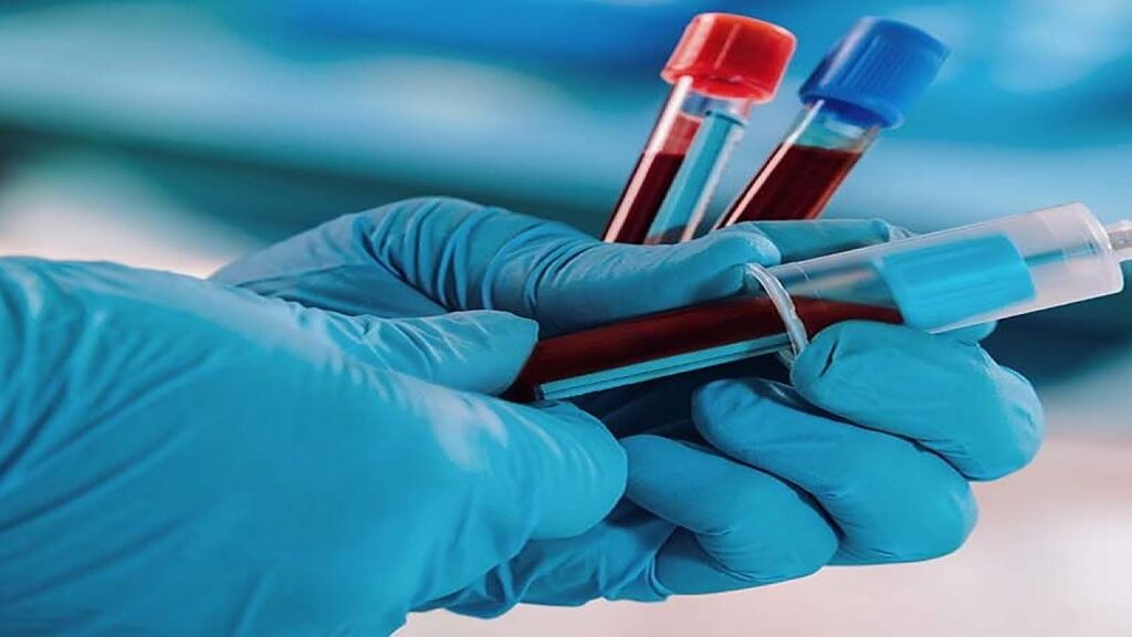Phlebotomy Basics - Phlebotomy Basics Knowledge Saves Lives