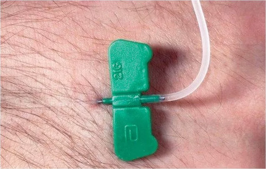 Subcutaneous Infusion - Subcutaneous Infusion