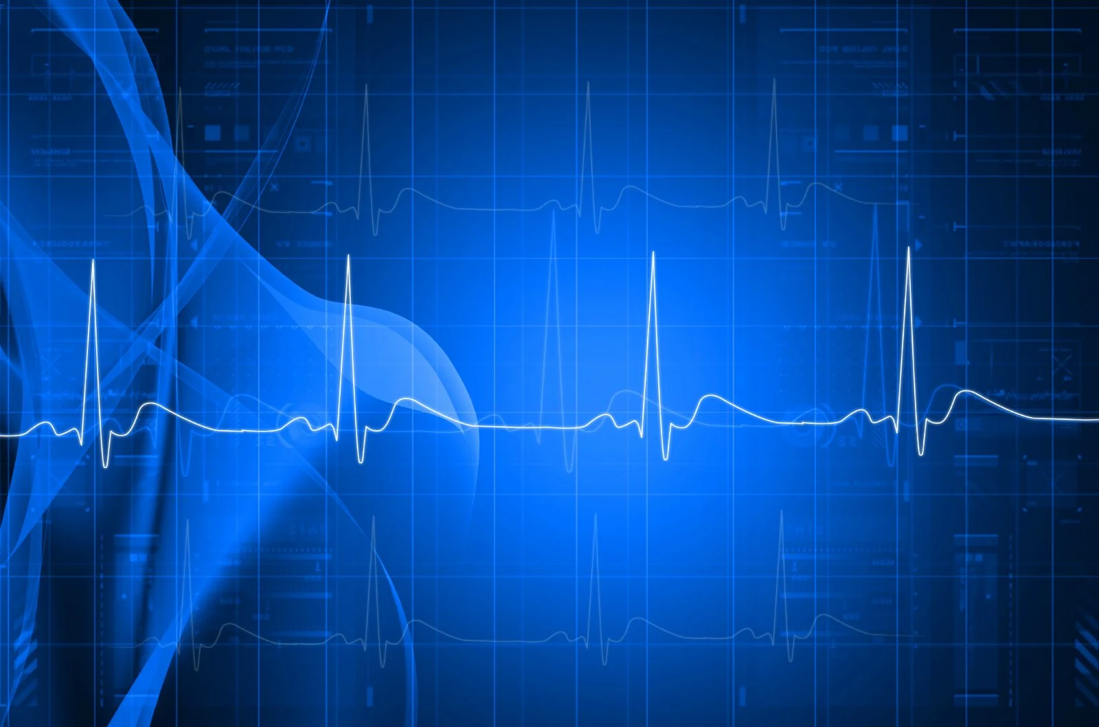 Advanced ECG Training. - ALPHA LIFE TRAINERS Knowledge Saves Lives