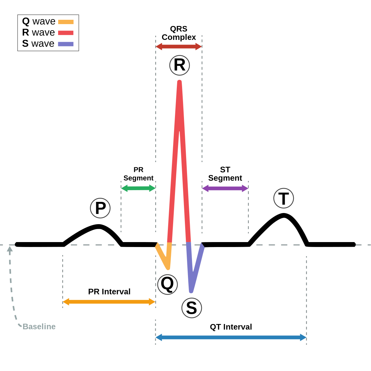 What is ECG - What is ECG Knowledge Saves Lives